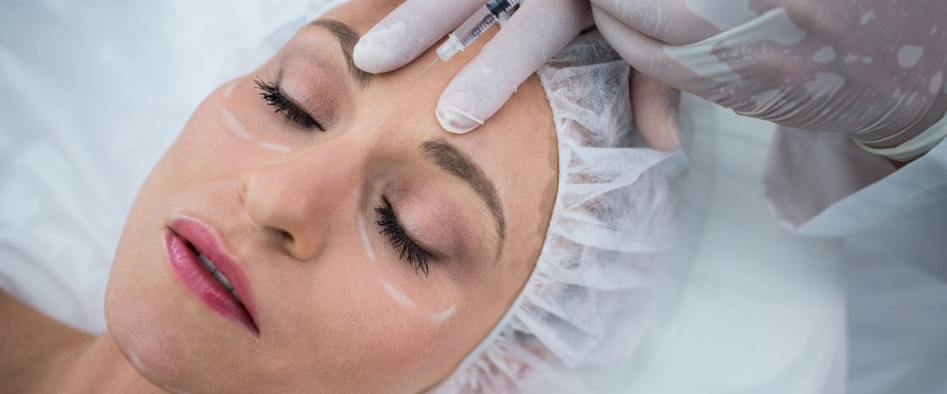 Botox Injections: An Overview